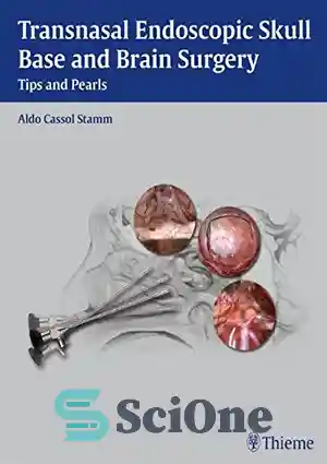 دانلود کتاب Transasal endoscopic skull base and brain surgery: tips and pearls – جراحی آندوسکوپی ...